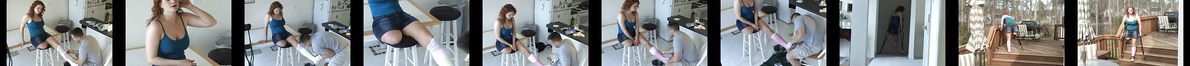 Free Leg Cast Porn Videos Xhamster